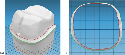 Process Of Defining Width Of Preparation Margin Area A Width Of Download Scientific Diagram