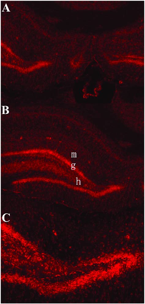 Histological Verification Of Virus Infection In Hippocampus A And B Download Scientific