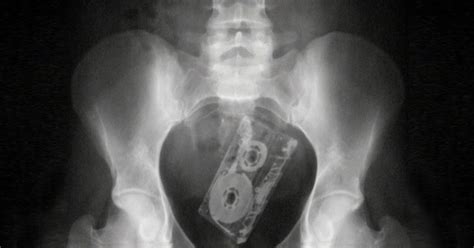 Caustic Takes Fan S Response To Limited Edition Cassette Literally Riveting News