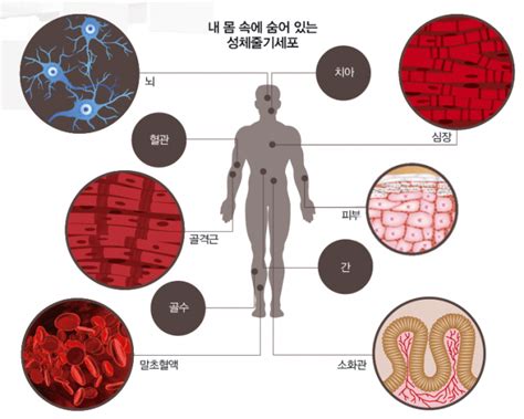 세포 치료의 종류와 원리 네이버 블로그