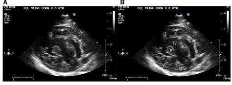 Two Dimensional Echocardiograms Of The Heart A Right Parasternal Download Scientific Diagram