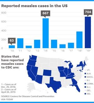 Measles Outbreak Heres What You Need To Know About The Disease
