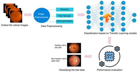 Applied Sciences Free Full Text Transfer Learning For Diabetic Retinopathy Detection A