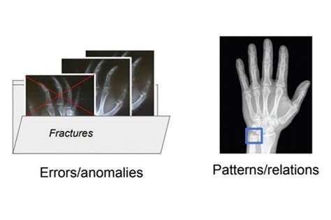 Artificial Intelligence In The Radiology Department