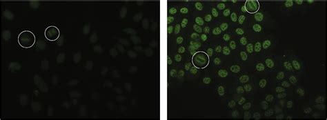 Figure 1 From Mitotic Cells Recognition In Hep 2 Images Semantic Scholar