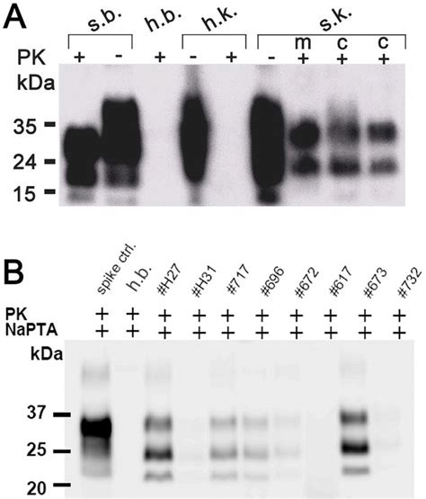 Western Blotting Prpsc Deposition In Scrapie Affected Sarda Sheep A