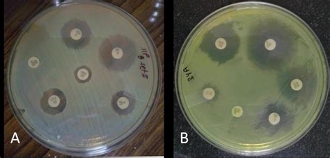 Antibiotic Susceptibility Testing Using Disc Diffusion Method A E Download Scientific