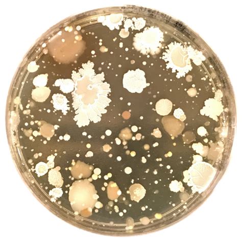 Bacteria Testing Guide Immunolytics