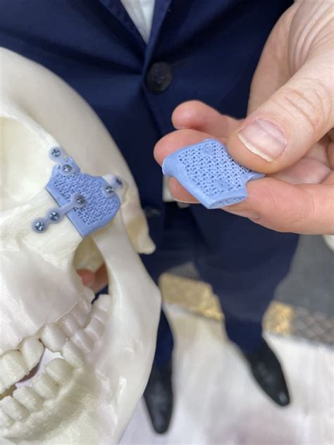 Lithoz Achieves A 30 Increase In Printer Sales In 2023