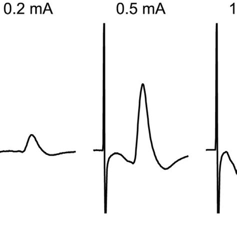 Retrograde Motor Neuron Labeling Along Cmap Recordings Lipophilic