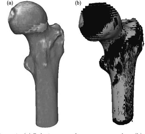 Figure 2 From An Automated Method To Estimate Femoral Shape And Mineral