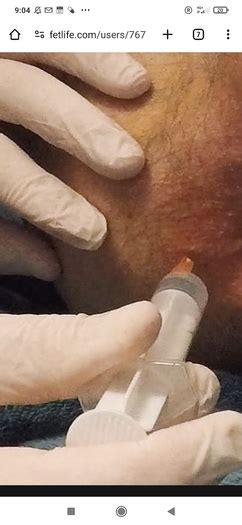 Injection Album 4 Image 4426351 Thisvid Tube