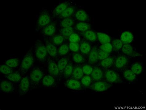 Stat1 Antibody 10144 2 Ap Proteintech