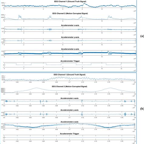 Eeg Topographic Maps Of Various Eeg Frequency Bands For The Whole