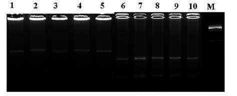 Restriction Patterns Of Pcr Amplified Fragments Of Its1 2 Digested With Download Scientific