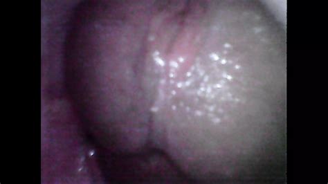 Free Endoscope Porn Videos Xhamster