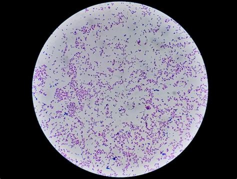 E Coli Gram Stain E Coli Appearing To Be Cocci Rmicrobiology