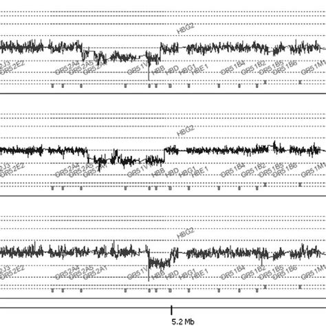 Examples Of Array Comparative Genomic Hybridization Download