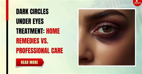 Dark Circles Under Eyes Treatment Home Remedies Vs Professional Care