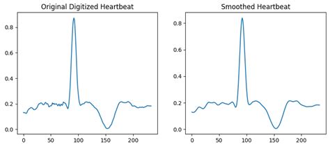 Sensors Free Full Text Cardiac Arrhythmia Classification Using Advanced Deep Learning