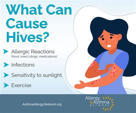Hives Allergy And Asthma Network