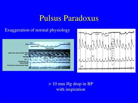 Ppt Pathophysiology Of Pericardial Disease Ims 350 Powerpoint