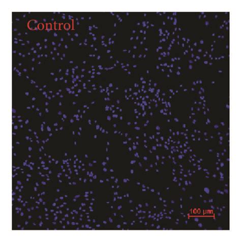 Immunofluorescence Staining Of Insulin In Rat Adscs Induced Into Download Scientific Diagram