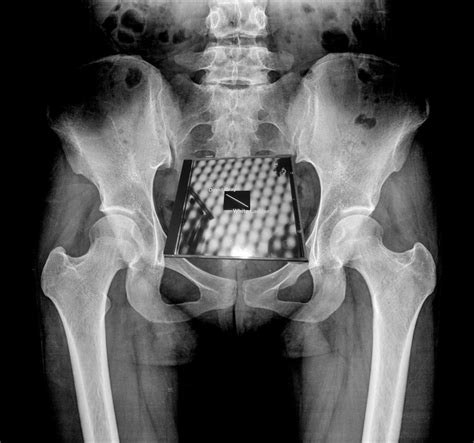 X Ray Sex Pics Gay Ass