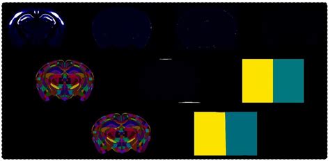 Atlas Based Segmentation Atlas Reference Image Top Left And Raw Data Download Scientific