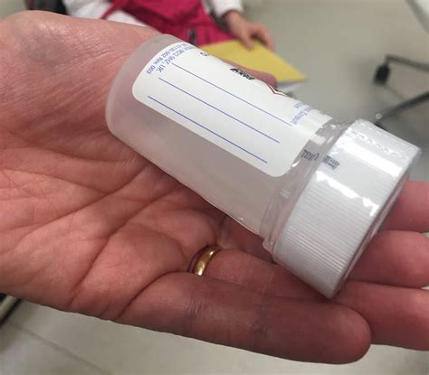 Understanding Cervical Screening Technology In The NHS