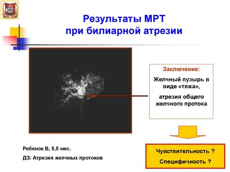 Пороки развития и заболевания желчных протоков и желчного пузыря у детей презентация онлайн