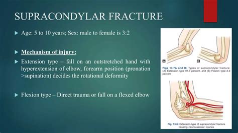 Supracondylar Fracture Of Humerus Pptx