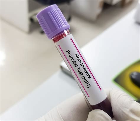 How A Blood Test Can Reveal Your Babys Gender Early