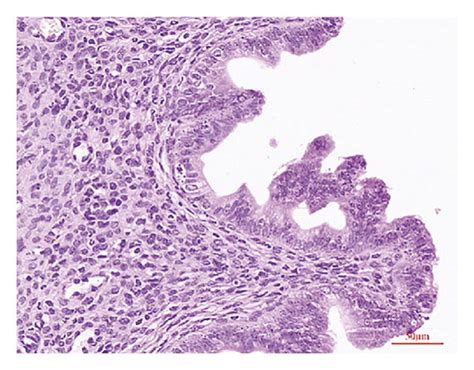 He Staining Of Am Mice Uteri In Each Group After 30 Days Of