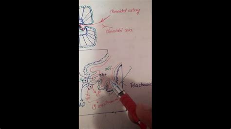 Choroid Plexus Structure And CSF Formation And Its Contents YouTube