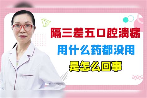 陈友琼 隔三岔五口就腔溃疡用什么药都没用这是怎么回事 口腔溃疡 口腔健康 陈友琼 口腔