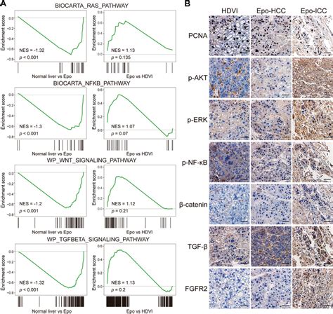 Signaling Pathways Activated In Maphdvi And Mapepo Tumors A Gesa