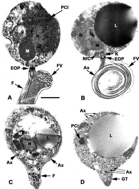Sections Illustrating Encystment Of Chytridium Olla Zoospore A