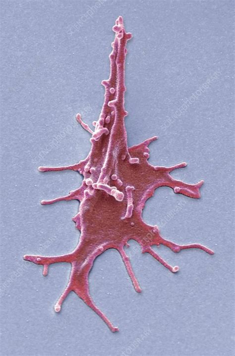 Activated Platelet Sem Stock Image C0481430 Science Photo Library