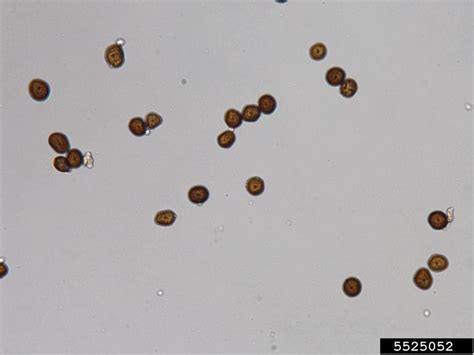 Corn Smut Microscope