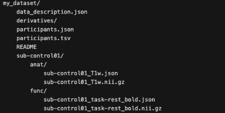 Rs FMRI Workflow From Preprocessing To Machine Learning Classification