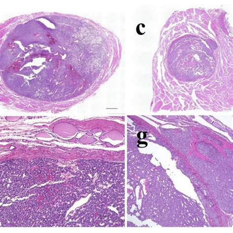 Representative Image Of Cut Surface Of Thyroid Follicular Patterned