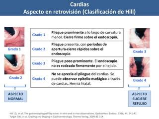 Clasificaciones Endoscópicas Amegpdf