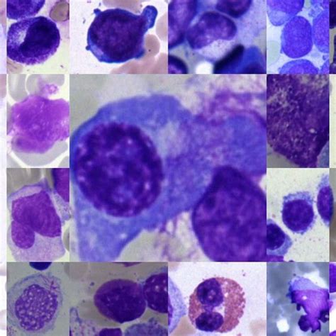 Bone Marrow Cells Of 21 Different Classes Download Scientific Diagram