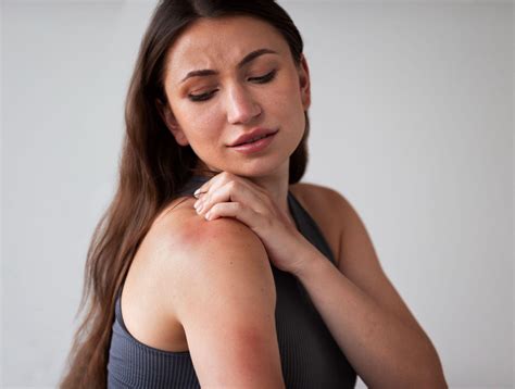 What Is Atopic Dermatitis Integrative Skin Science And Research