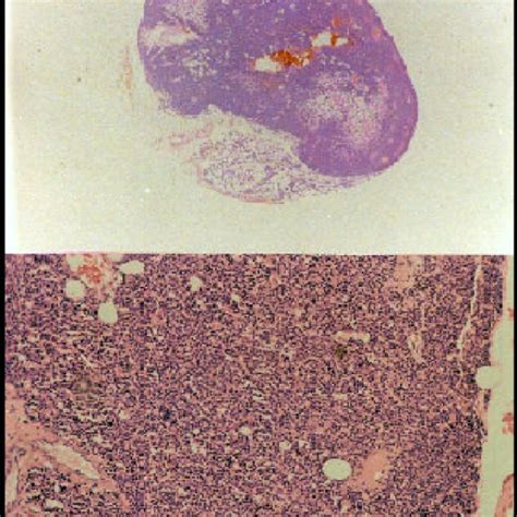 Characteristics In Cases With Recurrent Hyperparathyroidism After Download Scientific Diagram