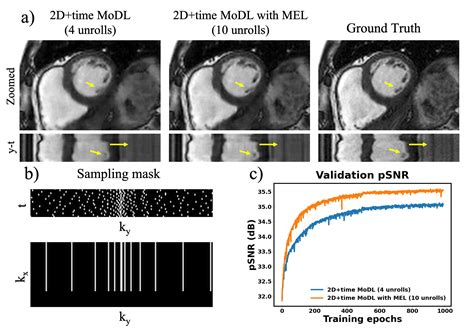 Memory Efficient Learning For High Dimensional Mri Reconstruction Deepai