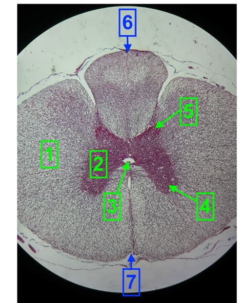 Week 3 Spinal Cord Tissue Diagram Quizlet Week 3 Spinal Cord Tissue Diagram Quizlet