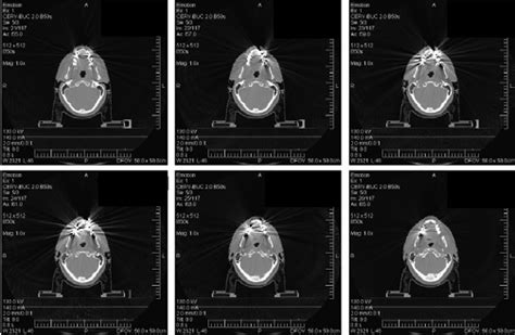 Ct Image Sequence Reconstructed Using The Sinogram Of Fig 3