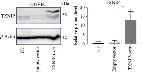 Txnip Overexpression Inhibits The Proliferation And Tube Formation Of